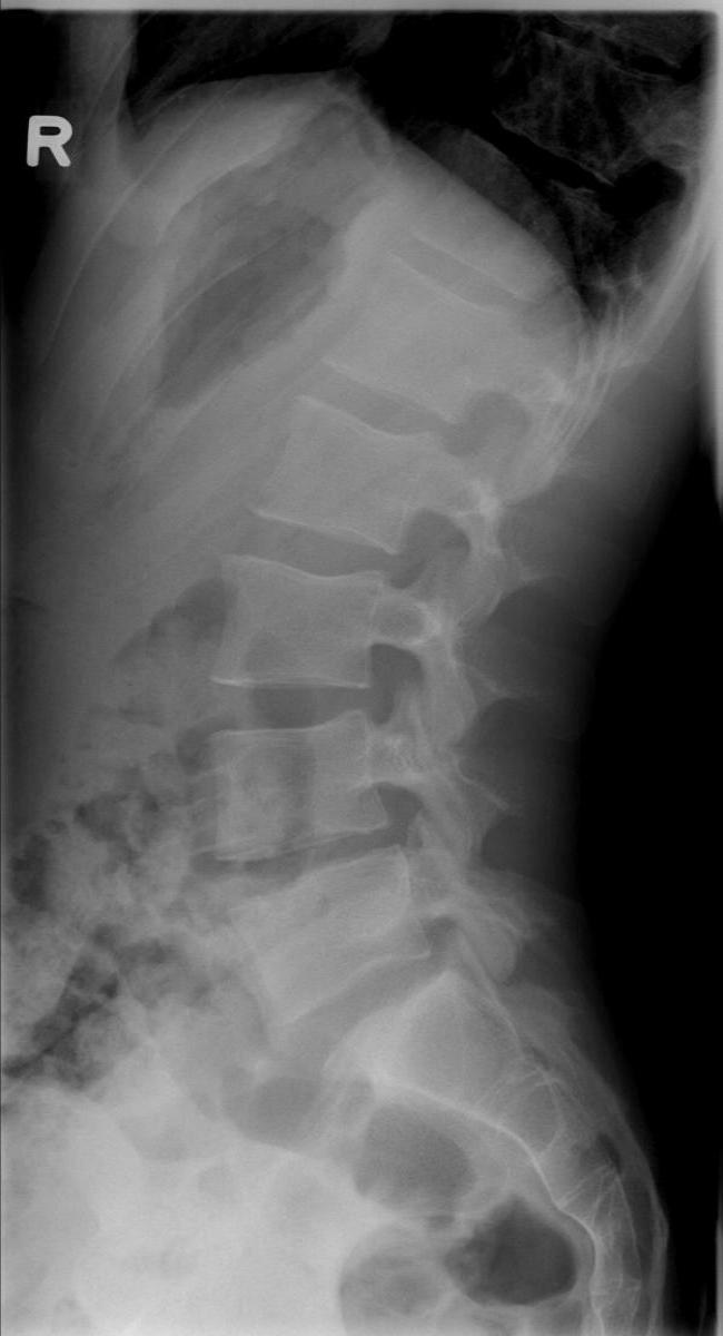 DIGITALES RÖNTGEN - Diagnostikum Berlin
