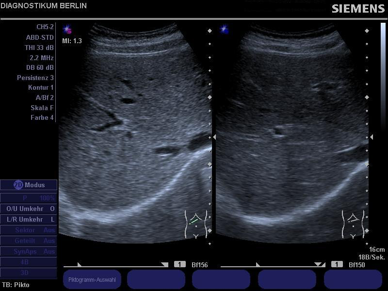 ULTRASCHALL - Diagnostikum Berlin